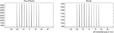 Computed Tomography Image Of Cancellous Bone Microstructure A Download Scientific Diagram
