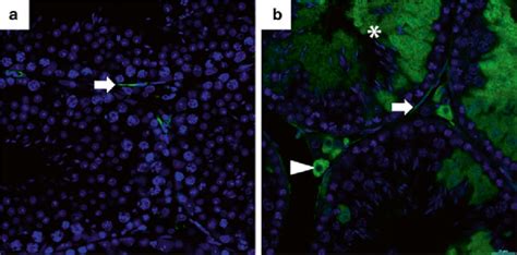 Localization Of Cre Recombination In A Tissue May Be Different From Download Scientific Diagram