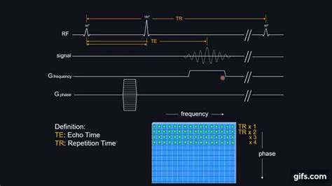 Mri Physics Mri Pulse Sequences Artofit