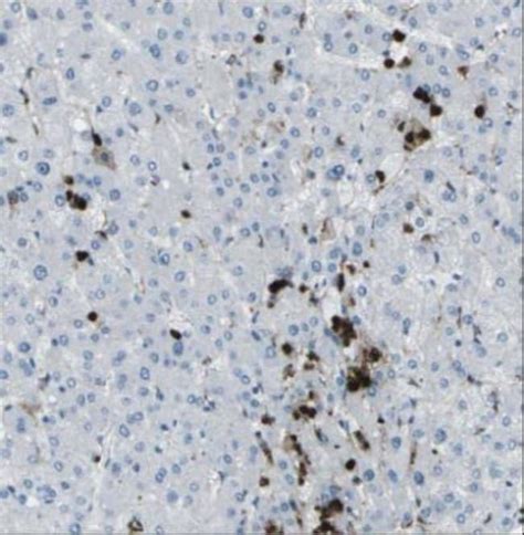 Ficolin 1 1 Bs 0025 Mg