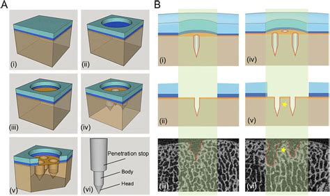 Schematic Of Microfracture Procedure In Animal Models And Micro Ct