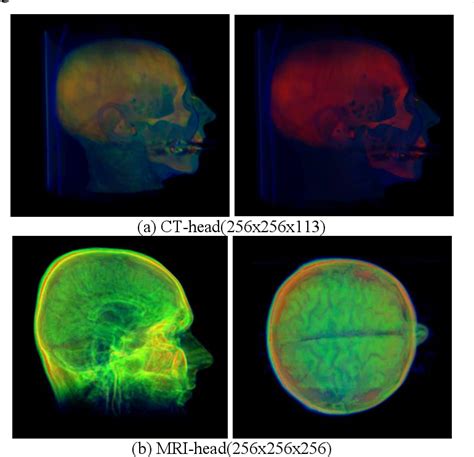 Figure 4 From Volume Rendering Transfer Function Design Based On