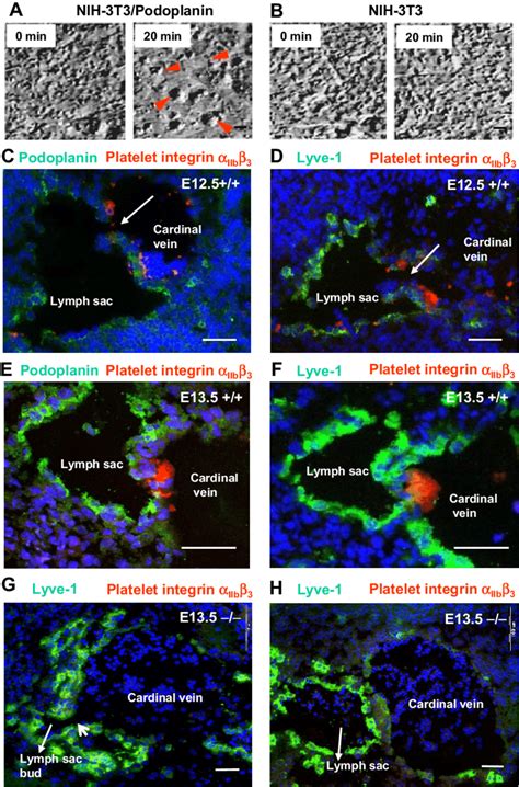 Platelet Aggregation