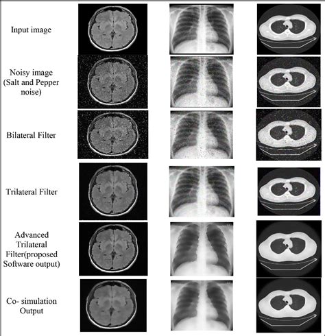 Figure 9 From A Field Programmable Gate Array Based Biomedical Noise