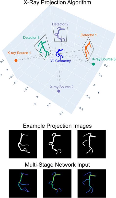 Schematic Of Synthetic X Ray Projection Generation Projections Were