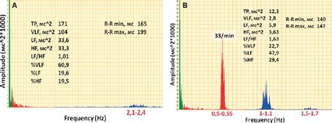 Figure 1 From Physiological Interpretation Of Heart Rate Variability
