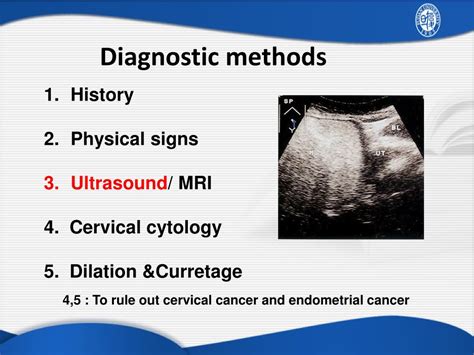 Ppt Uterine Myoma And Sarcoma Fudan University Weiwei Feng Md Ph D Email Jingsakura Gmail