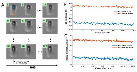 A Set Of 120 B0 Field Maps A In A Slice Arbitrarily Selected From The