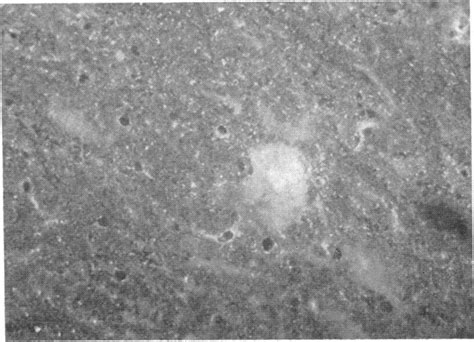 A B Specific Fluorescence In Cryostat Sections Throulgh The