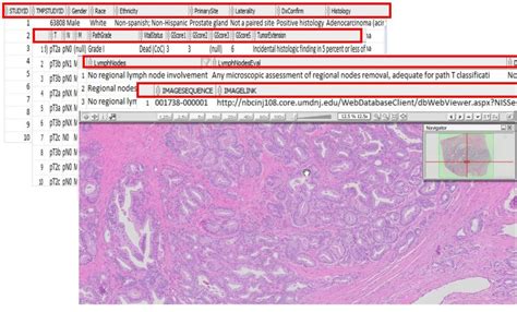 Support Research With Enriched Cancer Registry Data Center For Biomedical Imaging And Informatics