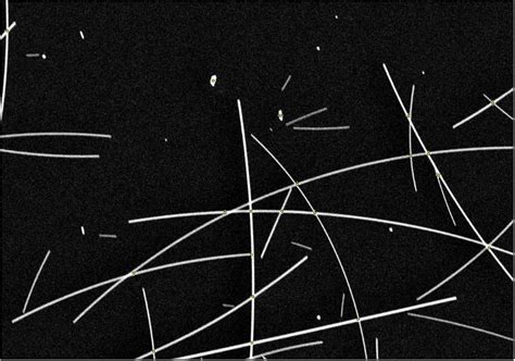 Counting Line Intersections Using Imagej Image Analysis Imagesc Forum