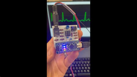 arduino nano based electrocardiogram ecg r arduinoprojects