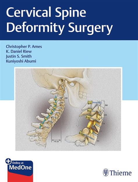 Cervical Spine Deformity Surgery Orthopedics