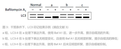 自噬 Marker Lc3b你研究对了吗？