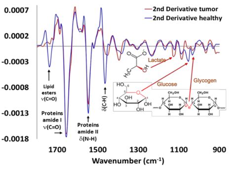Second Derivative Spectra Of A Pathological Mouse Brain Showing The
