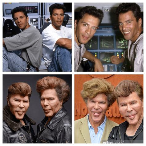Bogdanoff Twins R Botchedsurgeries