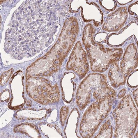 Rabbit Polyclonal Anti Pdha1 Antibody Buy For Research Highly Specific Rigorously Validated