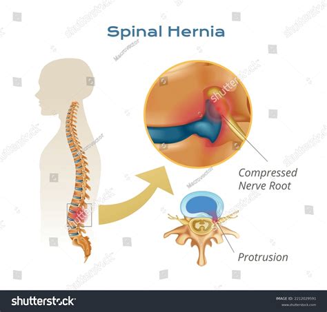 Vertebrae Spinal Cord Anatomy Infographics Body Stock Vector Royalty Free 2212029591