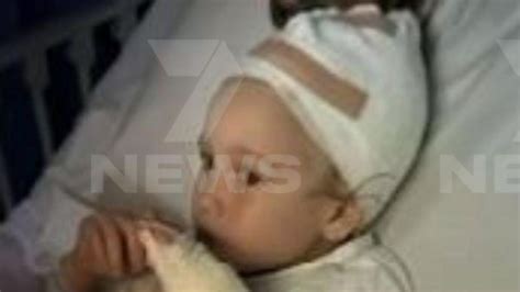 Six Year Old Girl Forced To Undergo Surgery After Being Mauled By Off