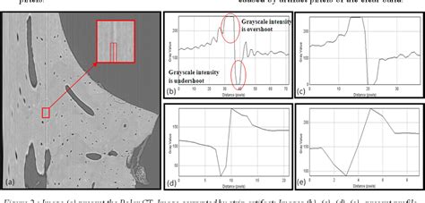 Figure 1 From Detection Of Ring Artifacts In Computed Tomographic