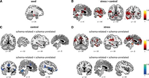 Stress Leads To Aberrant Hippocampal Involvement When Processing Schema Related Information