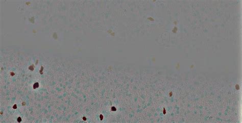 Filters Removing Marker Pen Artifacts From Scanned Microscope Slide