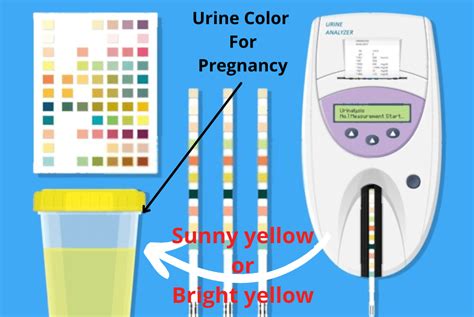 This Urine Color Chart Explains How To Read Your Pee Bulletproof