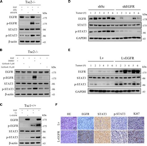 Runx1egfr Pathway Contributes To Stat3 Activation And Tumor Growth