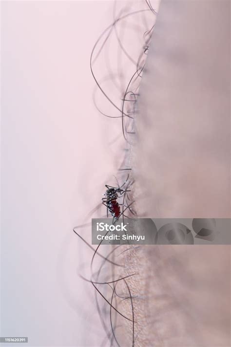 클로즈 업 애 데 아 이집트 티 인간의 피부에 일반적인 집 모기 혈액 인간을 빠는 애 들 이집트 티 가득 찬에 대한 스톡 사진 및 기타 이미지 Istock