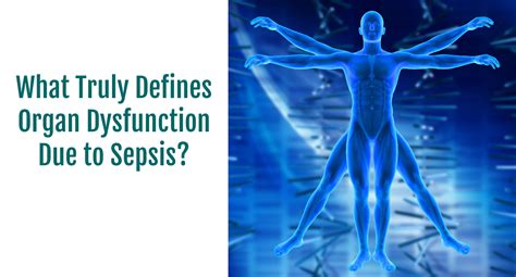 What Truly Defines Organ Dysfunction Due To Sepsis Sepsis Program