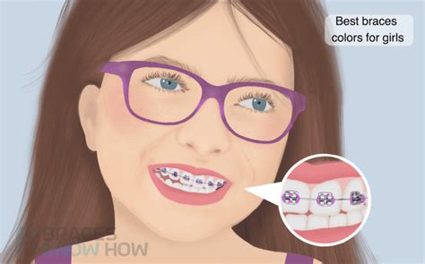 What Braces Colors Should You Avoid Some Might Surprise You Pastel Colors Green Colors Light