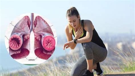 Exercise Induced Bronchoconstriction Breathing Difficulty After A Run Could Be A Sign Of