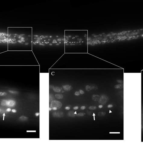 Dapi Staining Of Wild Type Caenorhabditis Elegans Clade 9 The