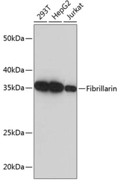 Fibrillarin Recombinant Rabbit Monoclonal Antibody Arc0506