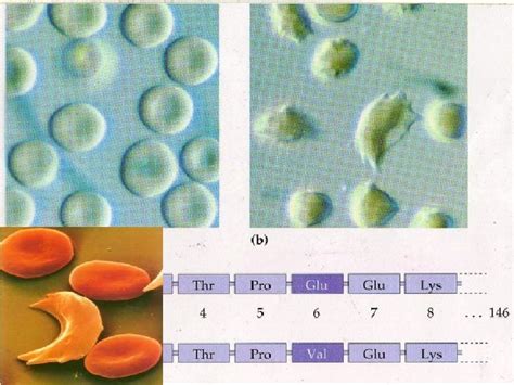 Patterns Of Inheritance Incomplete Dominance Codominance Multiple Alleles