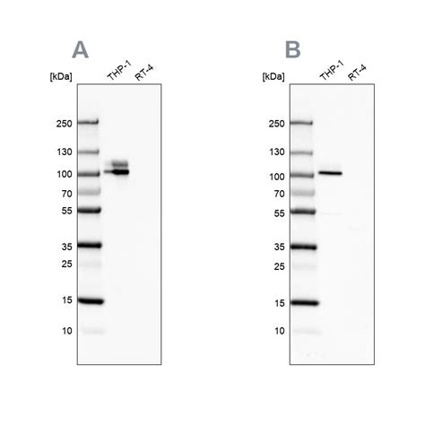 Anti Itgb2 Human Protein Atlas Antibody