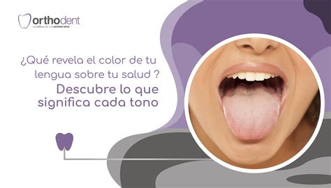 ¿cuál Es El Color Normal De La Lengua Y Su Importancia