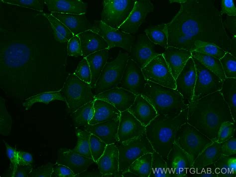 Beta Catenin Antibody Cl488 80488 Proteintech