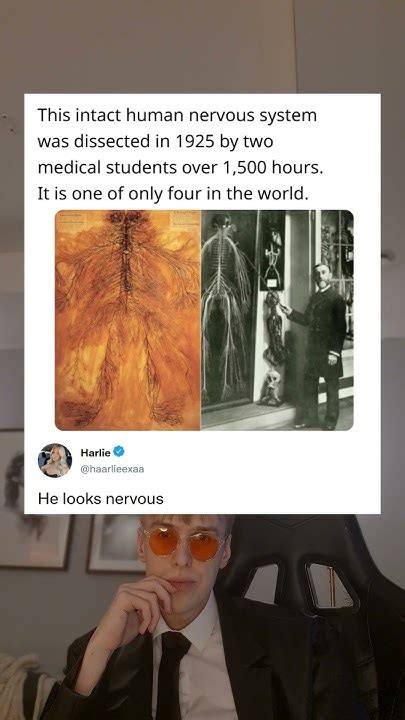 This Intact Human Nervous System Was Dissected In 1925 By Two Medical