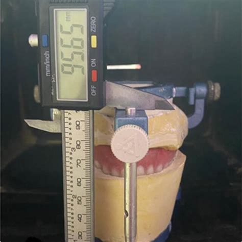 Shows The Digital Calliper Was Used To Measure The Distance Between Download Scientific Diagram