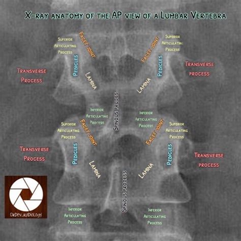 Пин от пользователя Alyssa Martin на доске Anatomy Радиология Анатомия