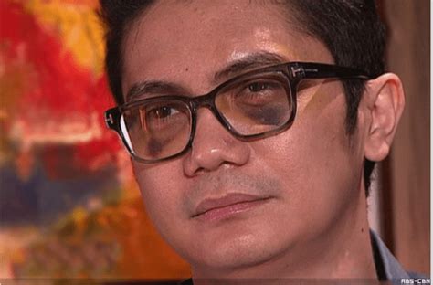 Vhong Navarro Denies The Viral Photo Of Burned Private Part Attracttour