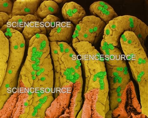 Enterococcus Faecium On The Small Inte Stock Image Science Source