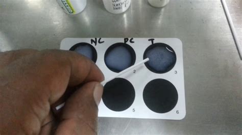 C Reactive Protein Crp Test Uses Procedure And Result 46 Off