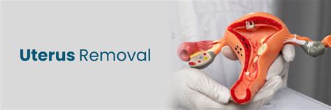 Uterus Removal Hysterectomy Reasons Types And Recovery