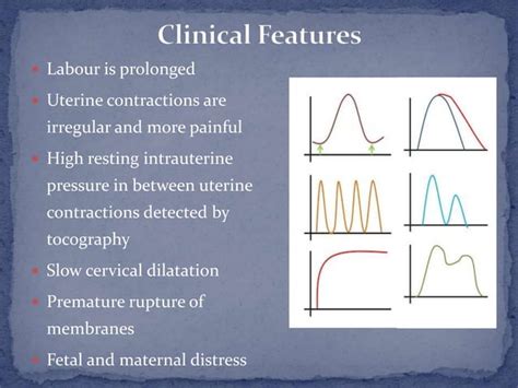 Disorders Of Uterine Contraction Precipitate Labor Premature Labor