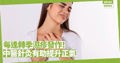 轉季濕疹發作，試盡方法冇改善？中醫針灸可提升正氣，外感六淫難乘虛而入，有得救！ 美女中醫 中醫養生 健康好人生 Etnet