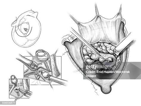 349 Temporal Lobe High Res Illustrations Getty Images