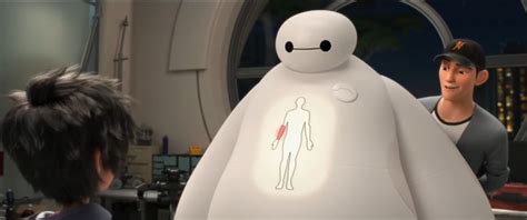 Baymax To Hiro Hamada Scan Complete You Have A A Slight Epidermal Abrasion On Your Forearm