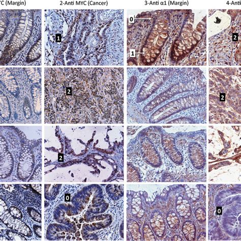 Representative Immunohistochemical Staining For Myc And Itga1 Download Scientific Diagram